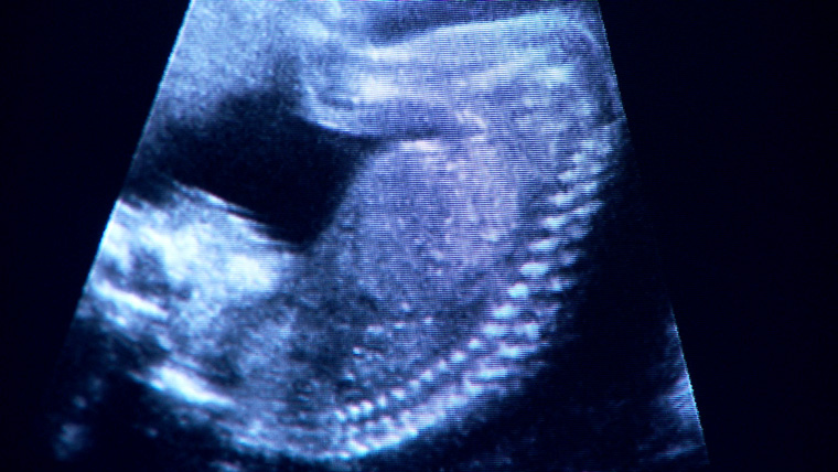 The Human Experiment